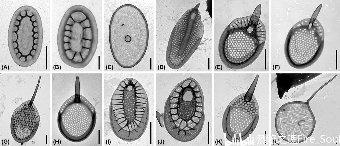 色藻界E04——黄群藻纲（Synurophyceae） - 哔哩哔哩