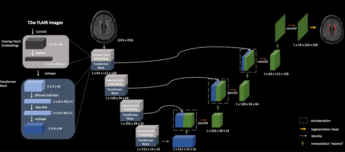 Transformer结合U-Net登上Nature子刊！最新成果让精度和效率都很美丽 - 哔哩哔哩