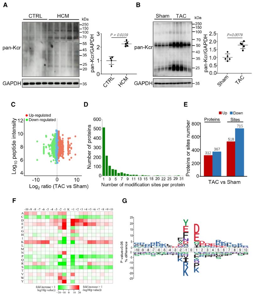 Circ Res | 青大/哈医大联合揭示：NAE1巴豆酰化修饰调控病理性心肌肥厚 - 哔哩哔哩