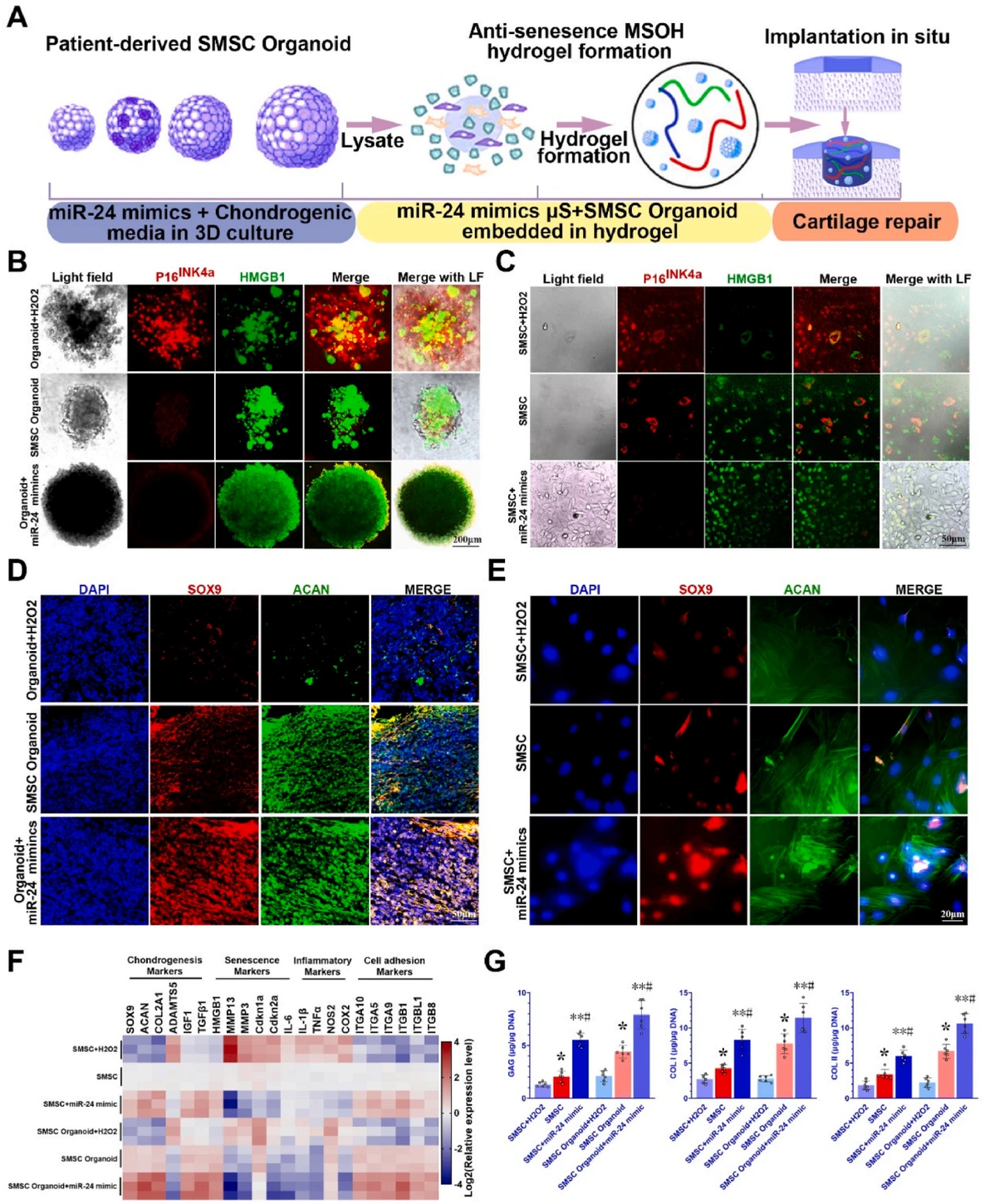 院士课题组首创衰老靶向SMSC类器官水凝胶，应用于软骨缺损修复 - 哔哩哔哩