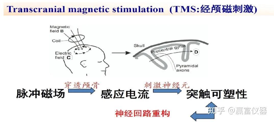 一文详解经颅磁刺激（TMS）的原理、功能与应用 - 哔哩哔哩