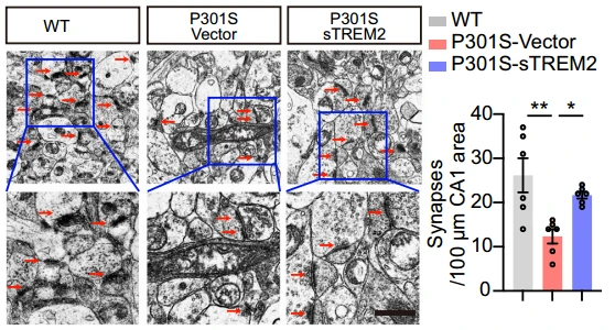 文献解读 | sTREM2有望改善AD患者的tau磷酸化和认知障碍 - 哔哩哔哩