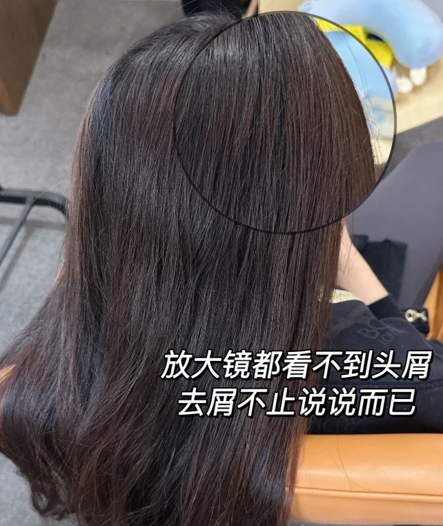 十岁男孩头皮屑多咋改善？这款适合儿童的洗发水帮你轻松解决？ - 哔哩哔哩