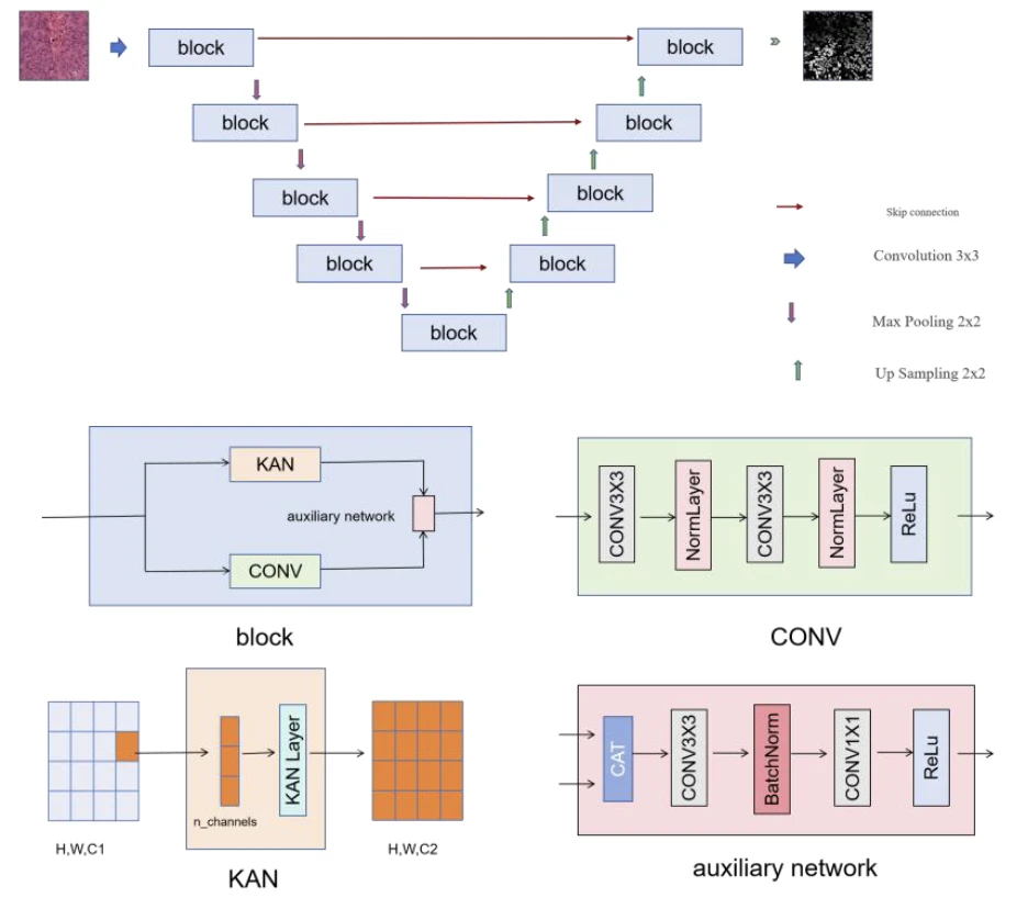 KAN+UNet：分割精度大幅提升，称霸医学图像领域！ - 哔哩哔哩