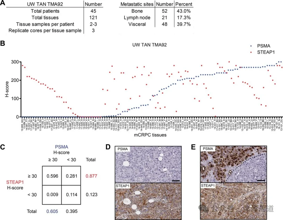 前列腺癌靶向治疗的热门靶点：STEAP1 - 哔哩哔哩