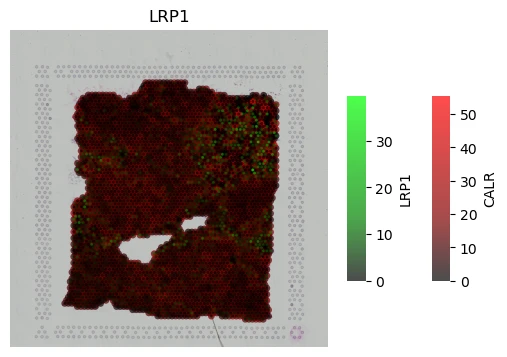【代码分享93】超详细！手把手级Python stlearn空间转录组CCI细胞相互作用分析（一） - 哔哩哔哩