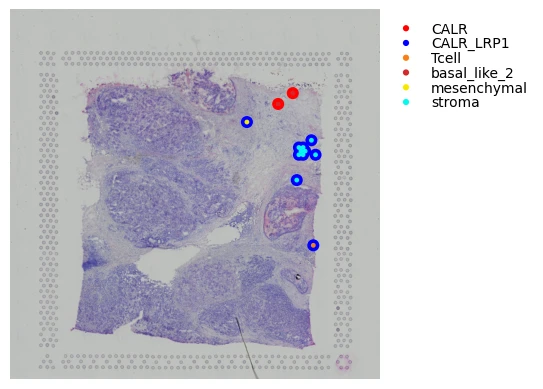 【代码分享93】超详细！手把手级Python stlearn空间转录组CCI细胞相互作用分析（一） - 哔哩哔哩