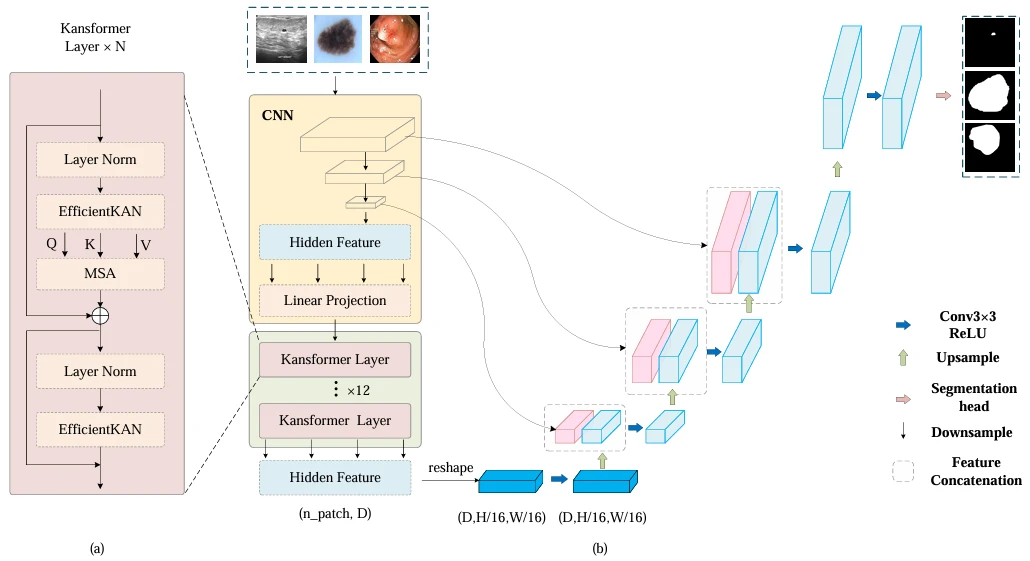 不得不服，这种KAN+UNet思路也太绝了！审稿人都得为你让条路！ - 哔哩哔哩