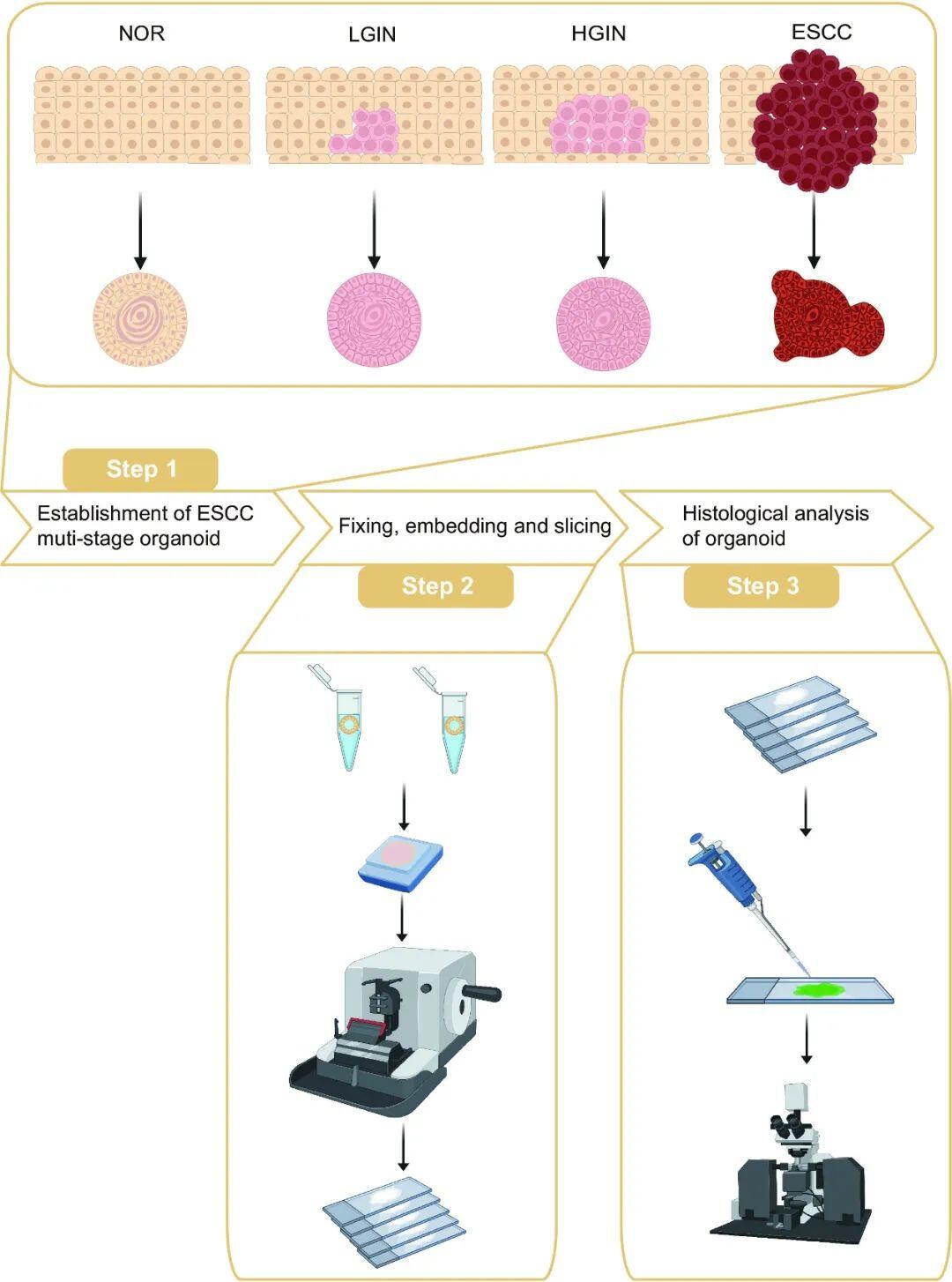 JoVE Protocol | 食管类器官建立及正常至癌性进展模拟 - 哔哩哔哩