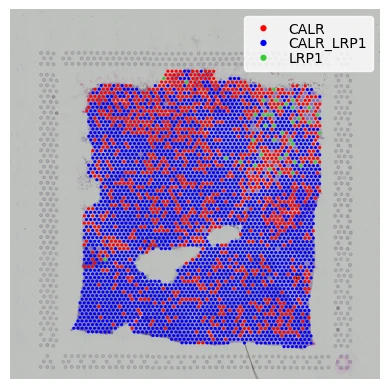【代码分享93】超详细！手把手级Python stlearn空间转录组CCI细胞相互作用分析（一） - 哔哩哔哩