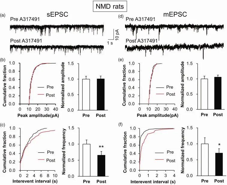 一文读懂神经元三种 "对话信号"：sEPSC、mEPSC与evoked EPSC - 哔哩哔哩