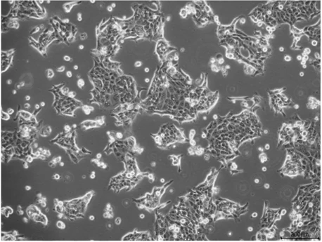 CFPAC-1、SW1990、PANC-1、Panc02胰腺癌细胞系培养合集来袭 - 哔哩哔哩