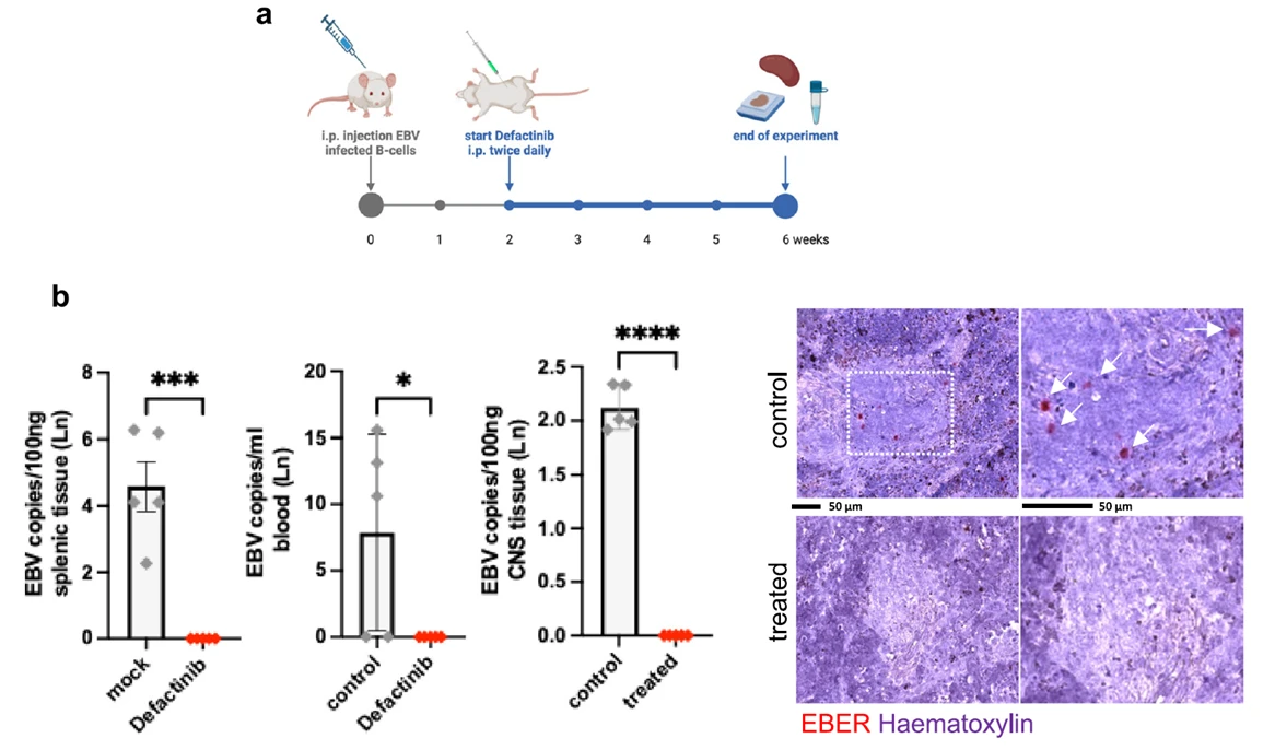 揭秘EBV诱导B细胞迁移：FAK与IL-10的关键作用 - 哔哩哔哩