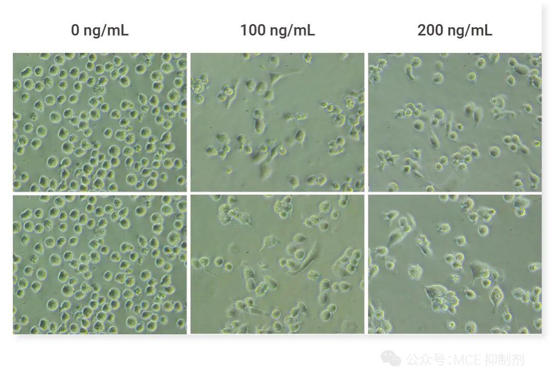 滴滴滴！巨噬细胞变形记：激活和分化指南 |MedChemExpress - 哔哩哔哩