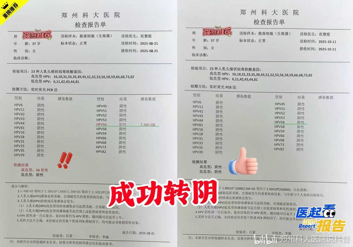 郑州科大医院治疗HPV感染怎么样？靠谱吗？高危hpv56阳性的专业之选 - 哔哩哔哩