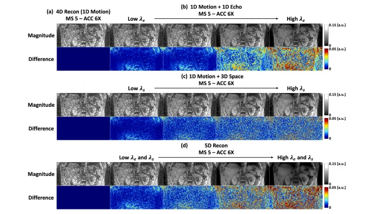 利用空间-运动-回波稀疏性进行5D图像重建，以实现自由呼吸状态下肝脏定量磁共振成 - 哔哩哔哩