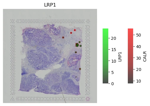 【代码分享93】超详细！手把手级Python stlearn空间转录组CCI细胞相互作用分析（一） - 哔哩哔哩