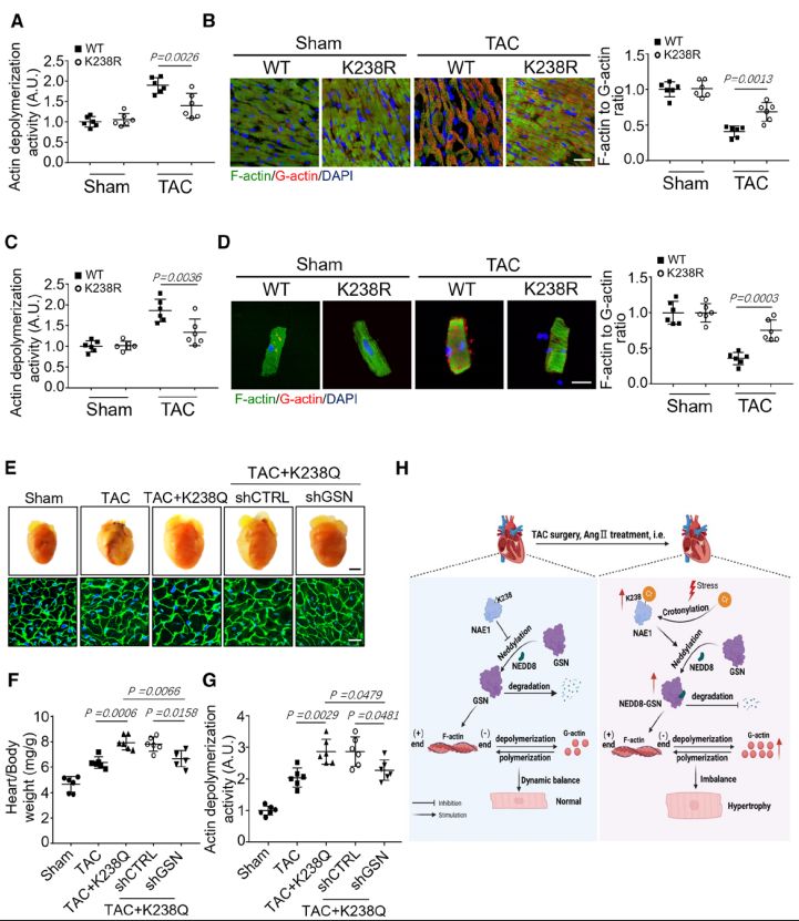 Circ Res | 青大/哈医大联合揭示：NAE1巴豆酰化修饰调控病理性心肌肥厚 - 哔哩哔哩