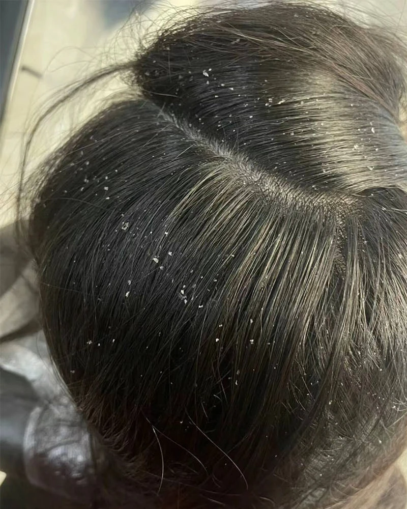 男士去屑止痒洗发水哪款最好?实测去屑止痒品牌配方 - 哔哩哔哩