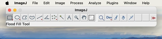 ImageJ软件统计Transwell小室细胞迁移数量（附ImageJ安装包） - 哔哩哔哩