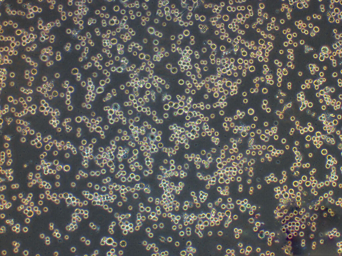 BEAS-2B Cells人支气管上皮细胞系|STR图谱 - 哔哩哔哩