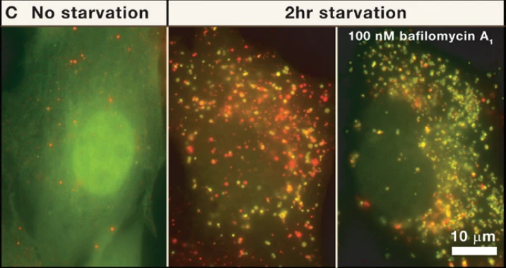 关于『细胞自噬』，发生过程、检测方法、研究思路，看这一篇就够了！ - 哔哩哔哩