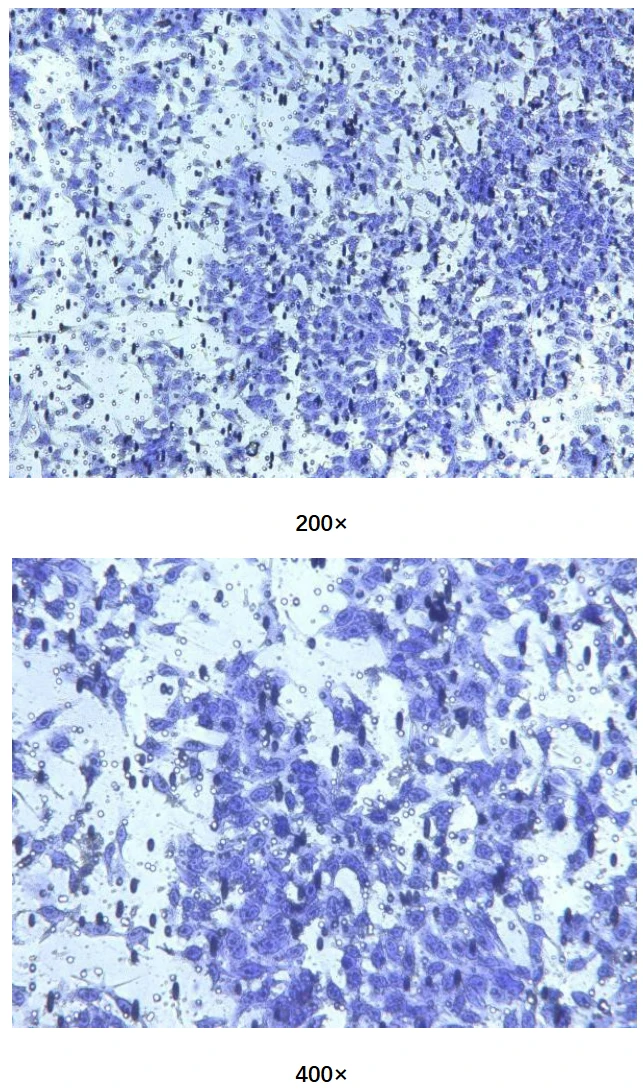 超详细Transwell细胞迁移实验记录 - 哔哩哔哩