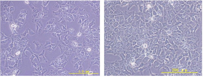 HepG2、SMMC-7721、Hep3B、Huh-7肝癌细胞系培养合集来袭！ - 哔哩哔哩