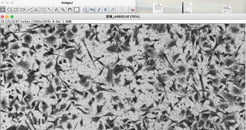 ImageJ软件统计Transwell小室细胞迁移数量（附ImageJ安装包） - 哔哩哔哩