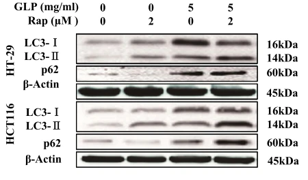 细胞自噬看这篇：发生机制、检测方法、研究思路，看完全明白！ - 哔哩哔哩