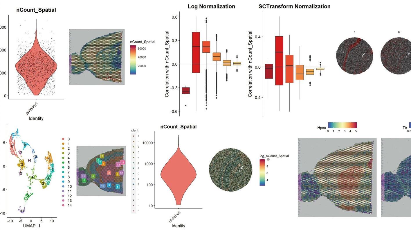 学会这些包，空转分析一网打尽！Stereopy、Squidpy、Seurat、S - 哔哩哔哩