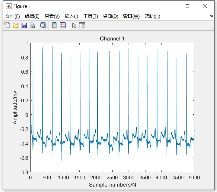 「ECG信号处理-第三课——WFDB工具包与MIT-BIH数据库读取」 - 哔哩哔哩
