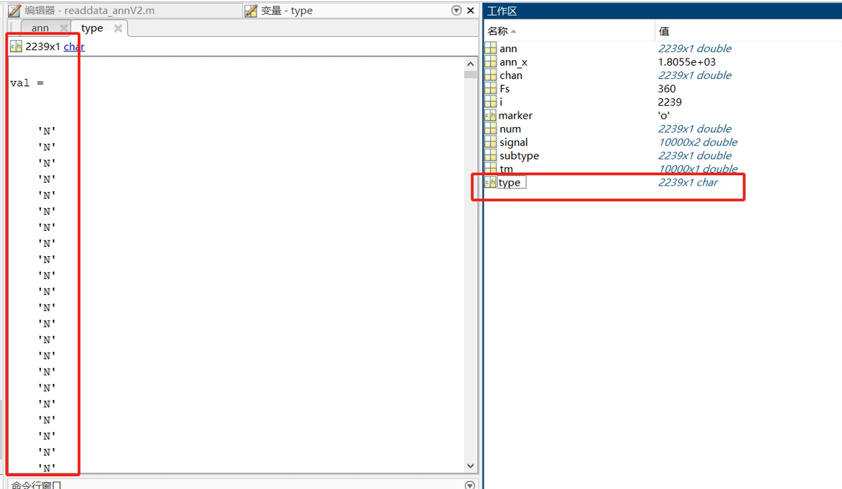 「ECG信号处理-第三课——WFDB工具包与MIT-BIH数据库读取」 - 哔哩哔哩