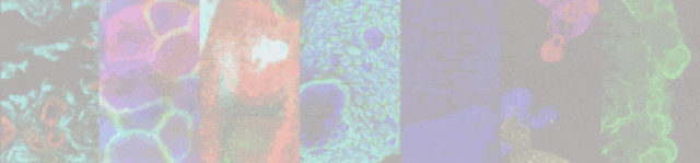 类器官芯片模拟囊纤病理及提升临床相关性：Mater Today Bio 综述 - 哔哩哔哩