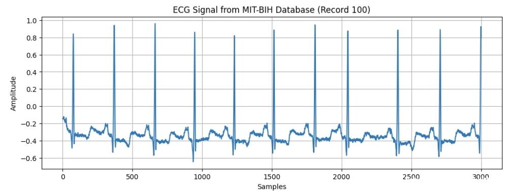 Python-wfdb读取MIT-BIH数据库 - 哔哩哔哩