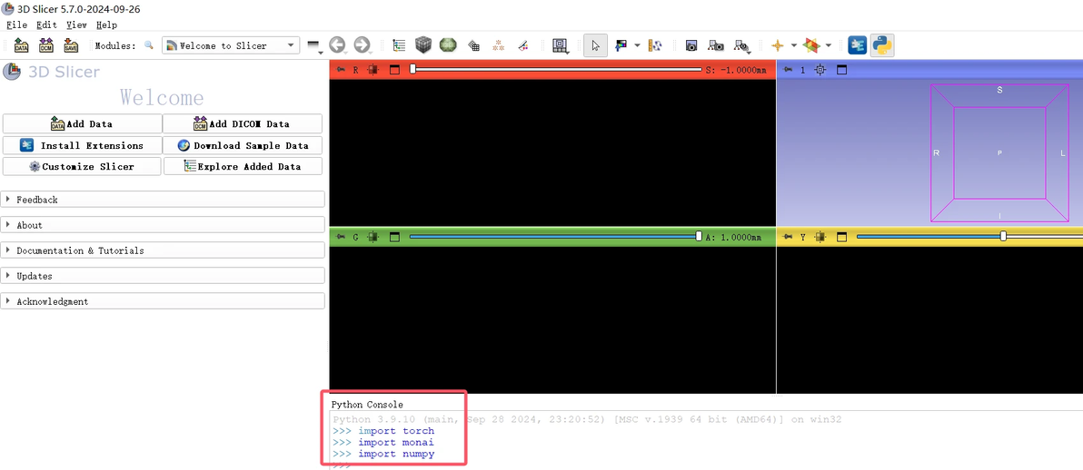 在3D Slicer中集成MONAI Auto3DSeg插件的经验分享(二) - 哔哩哔哩