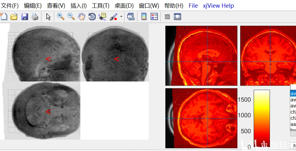 Log for today - 脑核磁成像工具xjview安装及可视化初步 - 哔哩哔哩