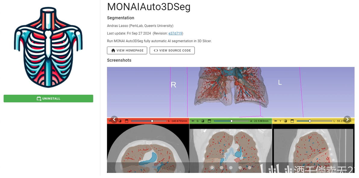 在3D Slicer中集成MONAI Auto3DSeg插件的经验分享(一) - 哔哩哔哩