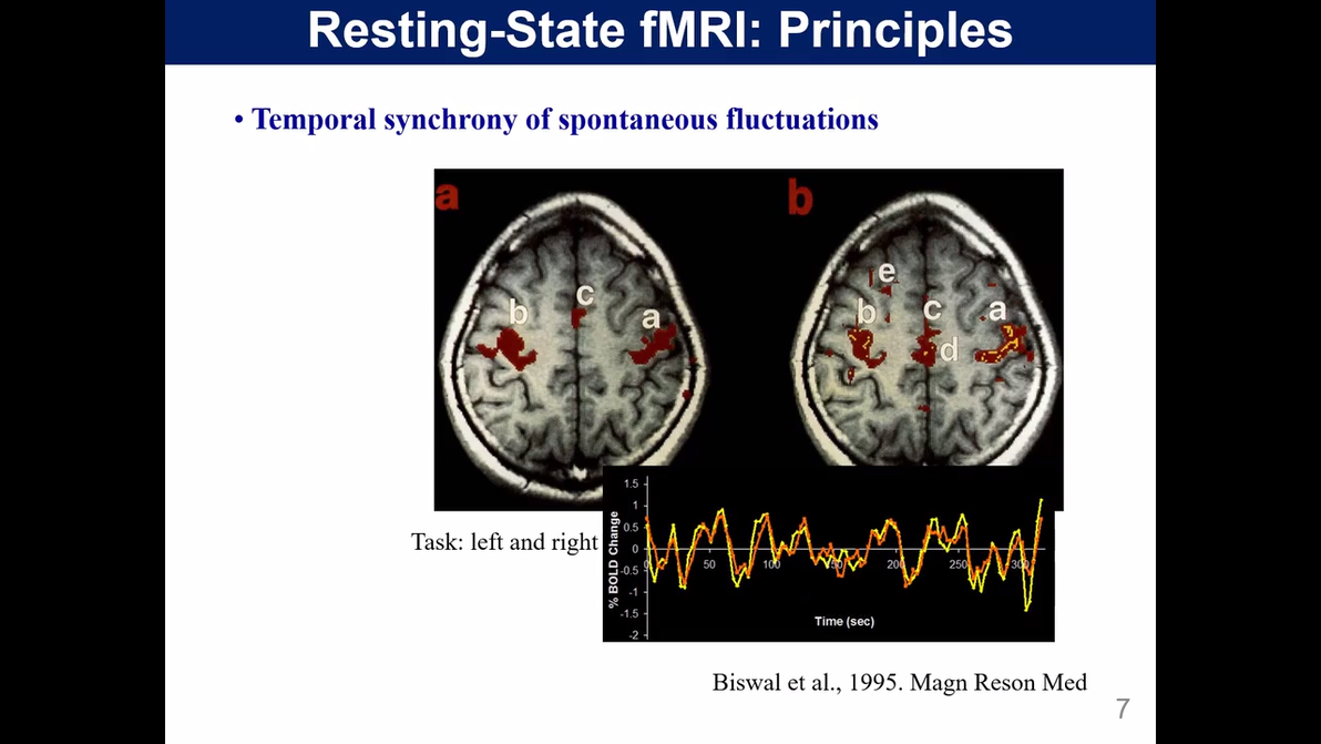 静息态功能磁共振成像(rs-fMRI)原理与数据分析,DPABI教程 - 哔哩哔哩