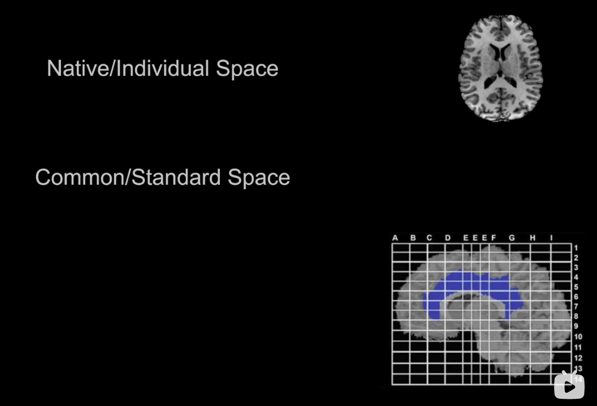 几个MRI的概念：Space，Template, Atlas - 哔哩哔哩