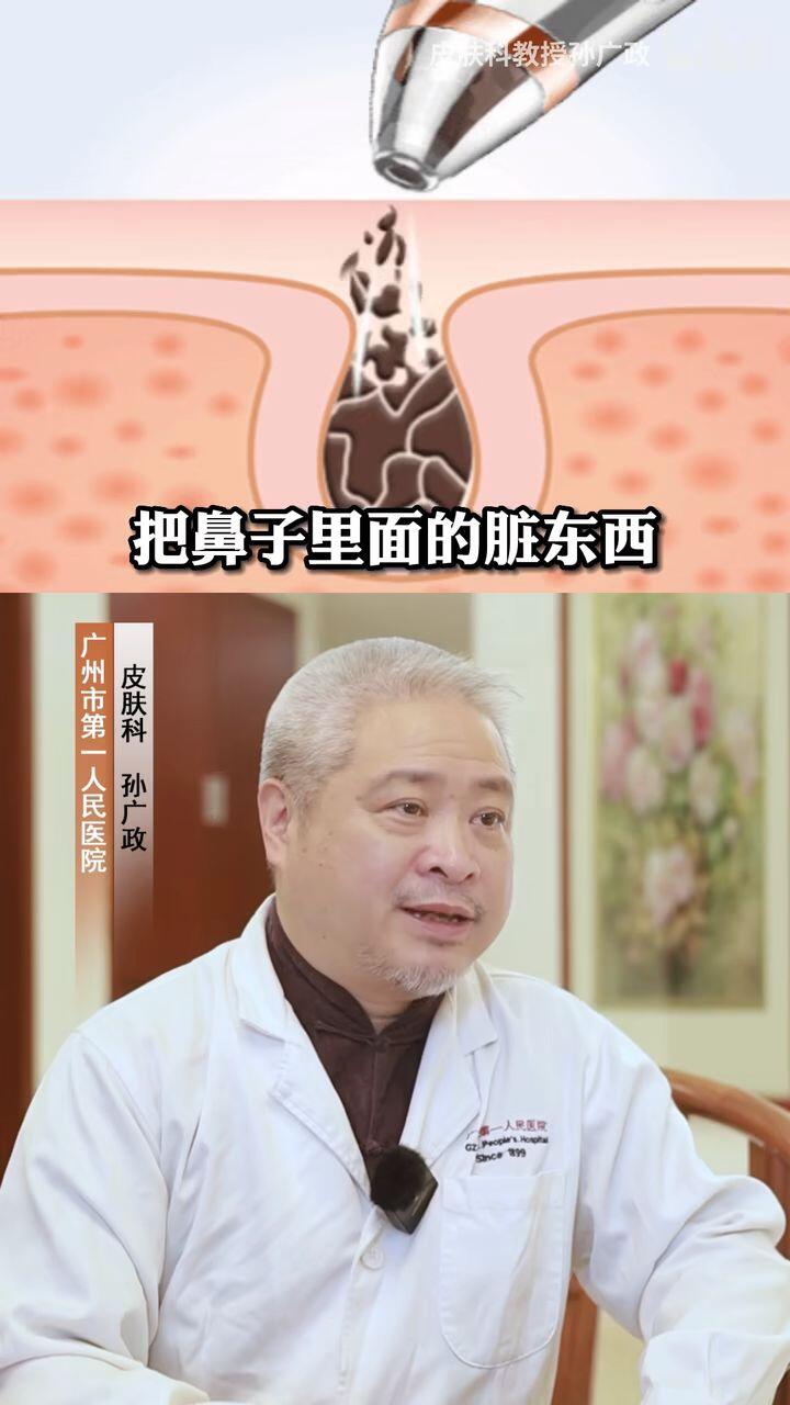【皮肤科孙叔】芦荟灌肤、小气泡、干细胞美容针,这些坑你们都踩过吗?孙叔带你避坑 哔哩哔哩