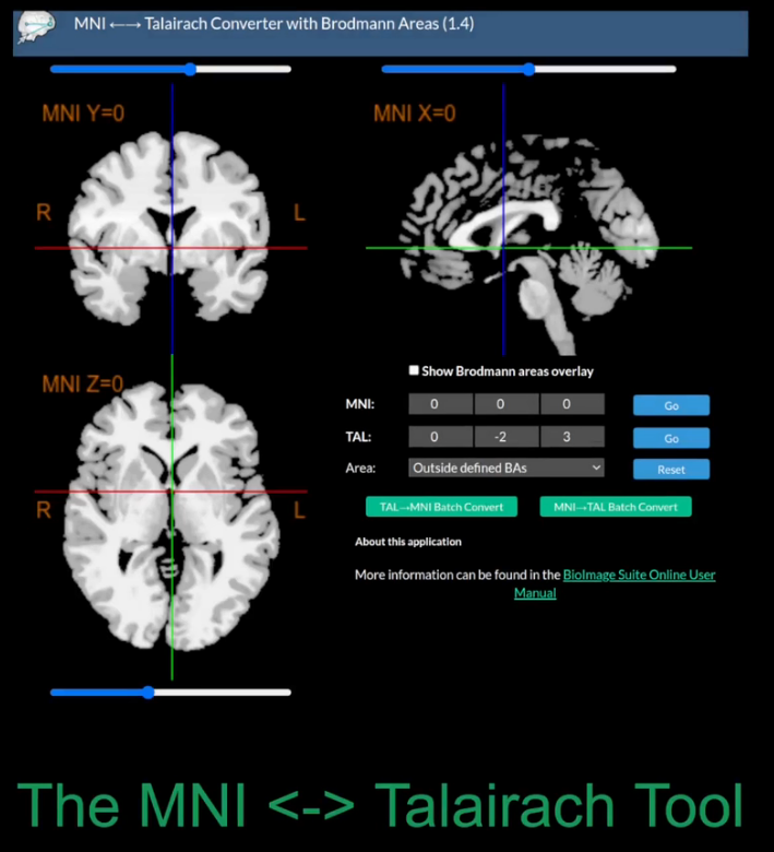 几个MRI的概念：Space，Template, Atlas - 哔哩哔哩