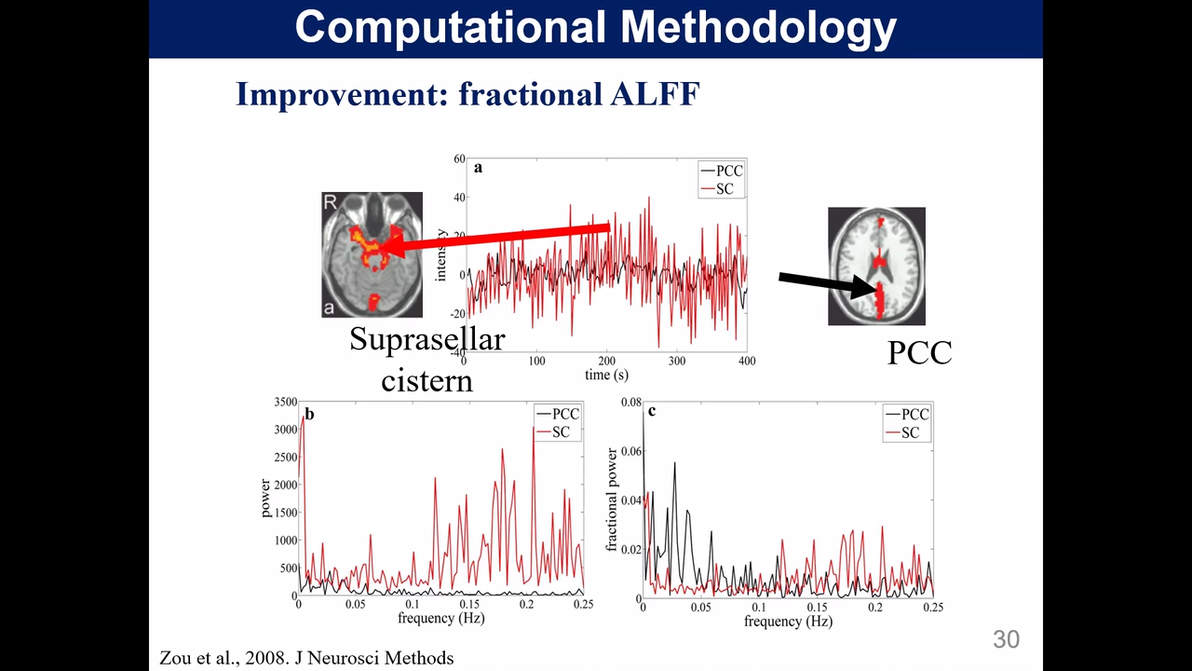 静息态功能磁共振成像(rs-fMRI)原理与数据分析,DPABI教程 - 哔哩哔哩