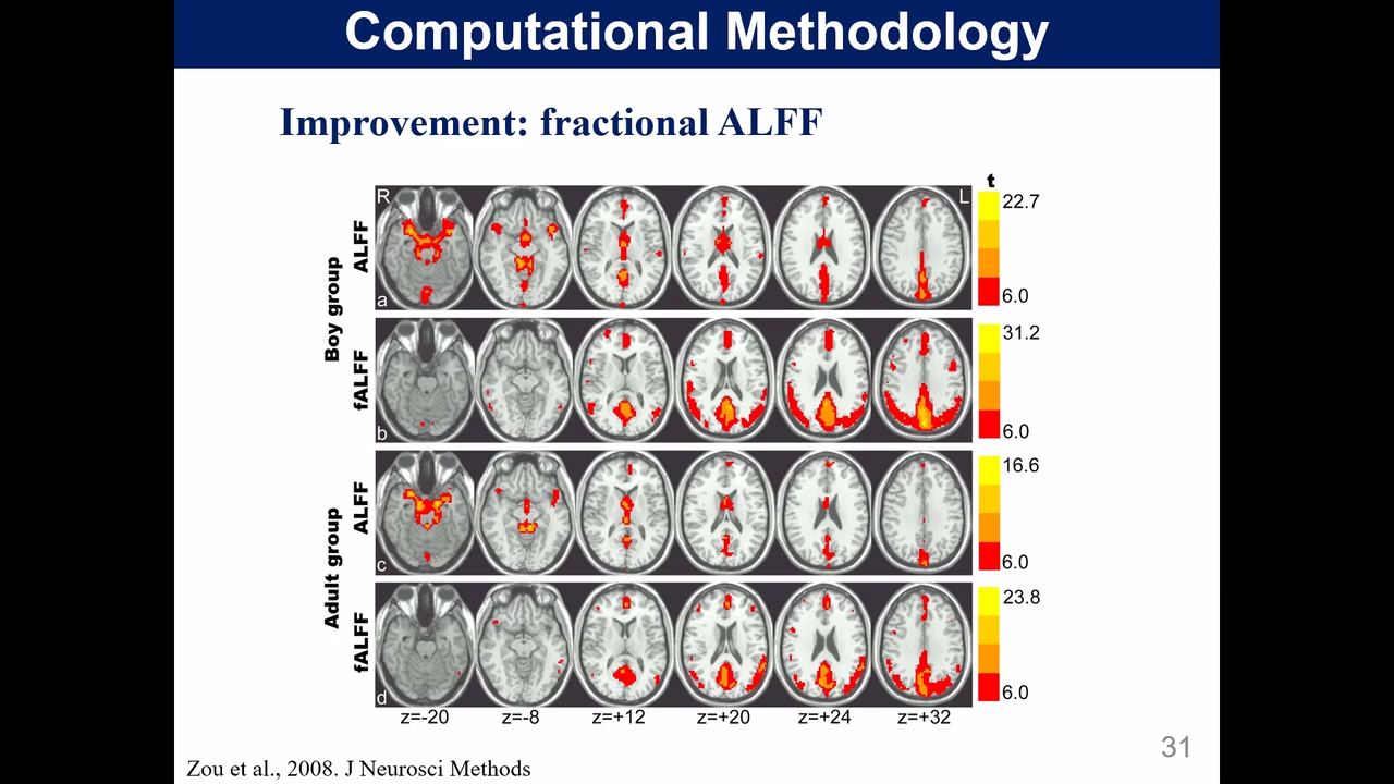 静息态功能磁共振成像(rs-fMRI)原理与数据分析,DPABI教程 - 哔哩哔哩