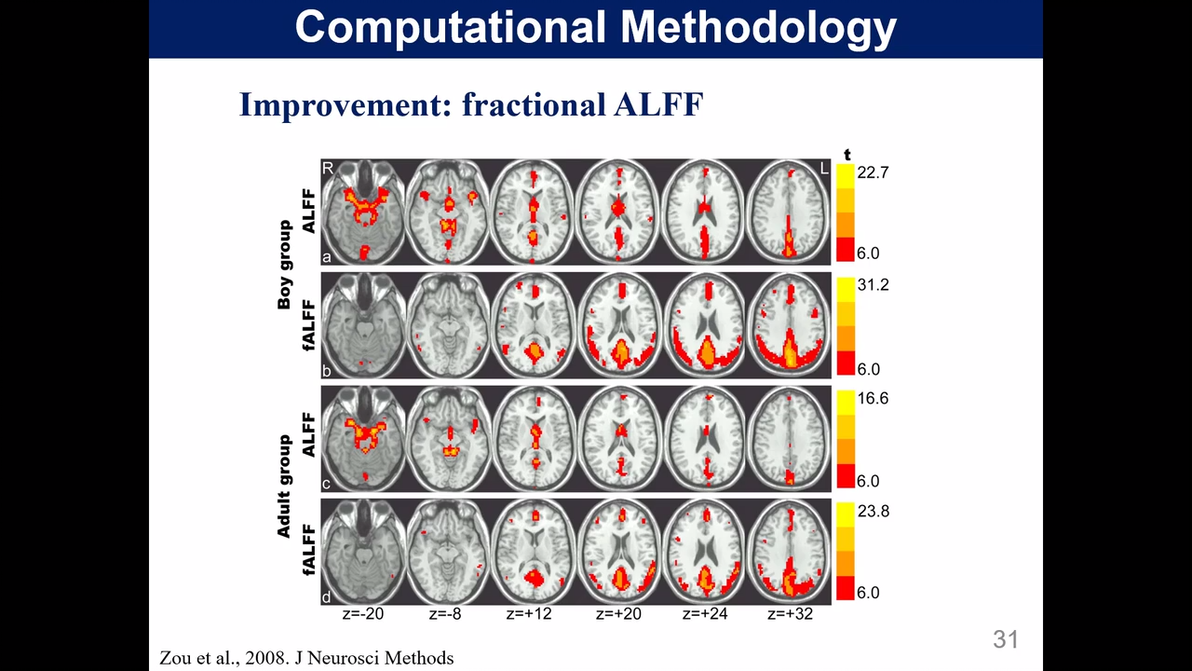 静息态功能磁共振成像(rs-fMRI)原理与数据分析,DPABI教程 - 哔哩哔哩