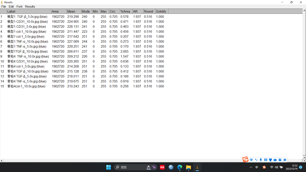 全网最简单免疫组化染色ImageJ数据统计及批量分析 - 哔哩哔哩