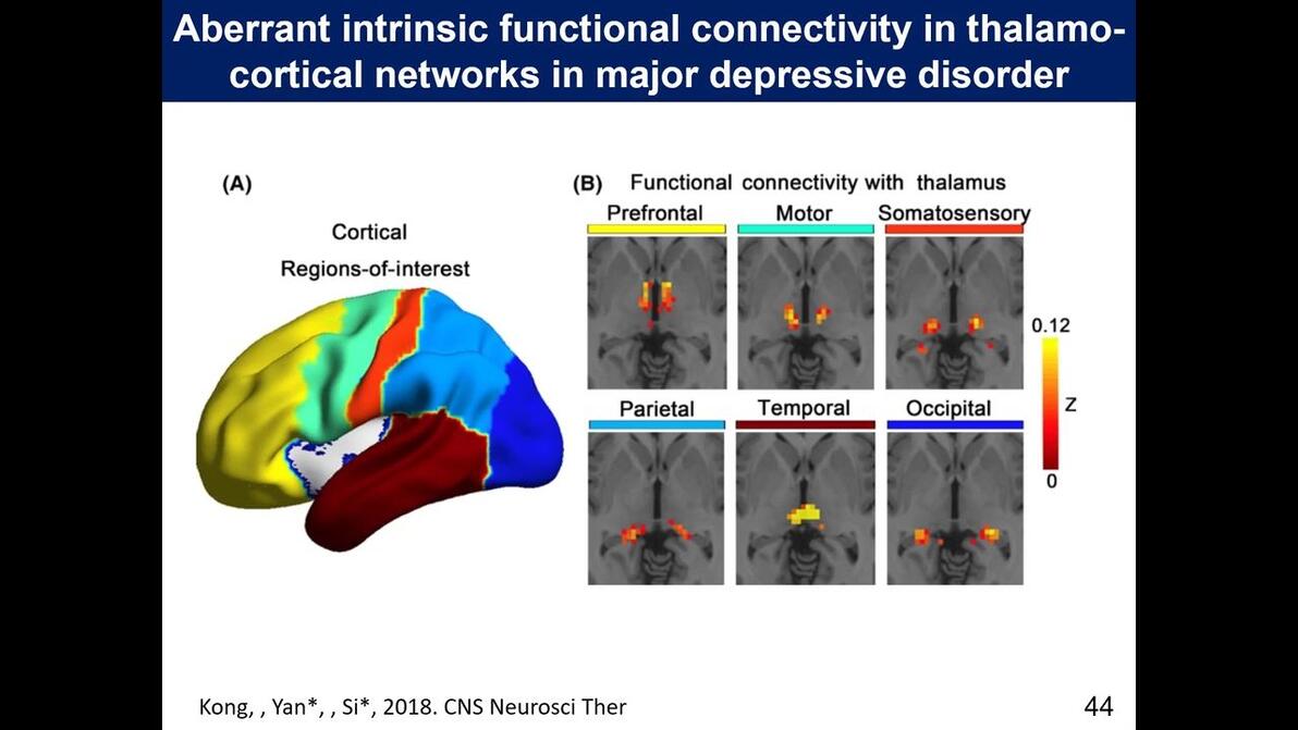 静息态功能磁共振成像(rs-fMRI)原理与数据分析,DPABI教程 - 哔哩哔哩